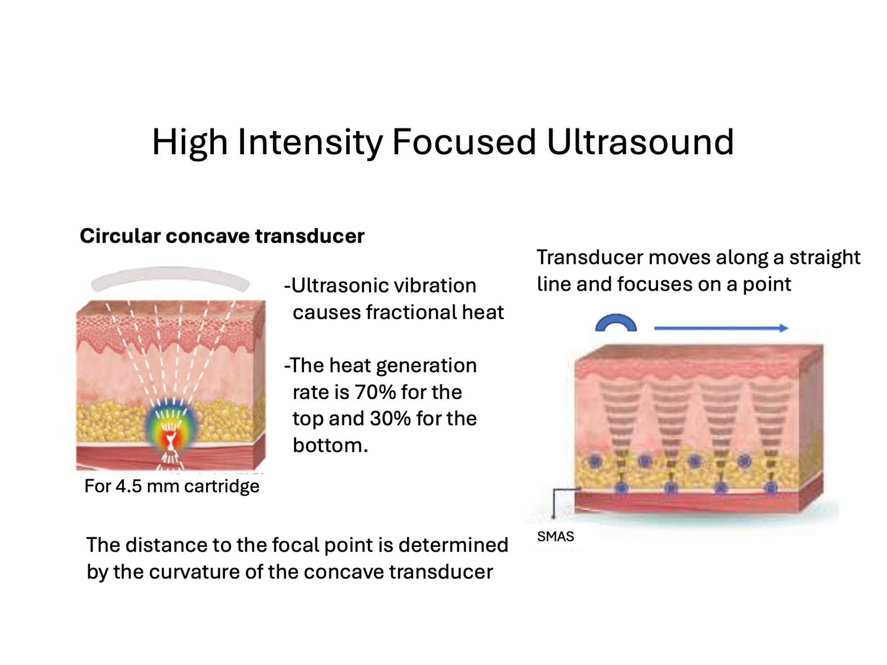 Premium HIFU Treatment with ‘ULTRAcel [zíː]’ | Clinician’s REPORT | Jeisys