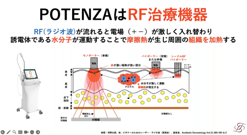 The Differences in Various POTENZA Tips and Their Use | Webinar Anytime ...