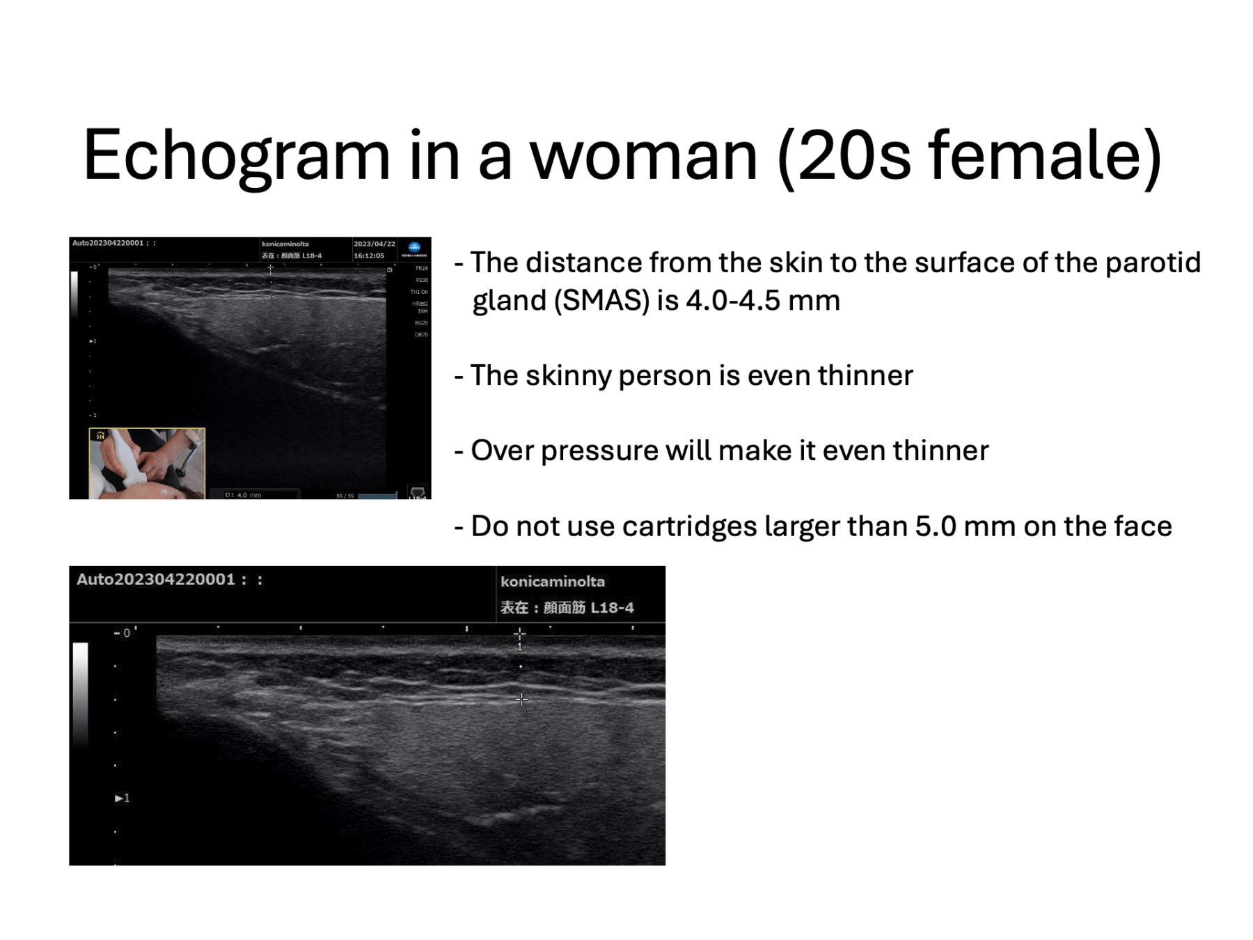 Premium HIFU Treatment with ‘ULTRAcel [zíː]’ | Clinician’s REPORT | Jeisys