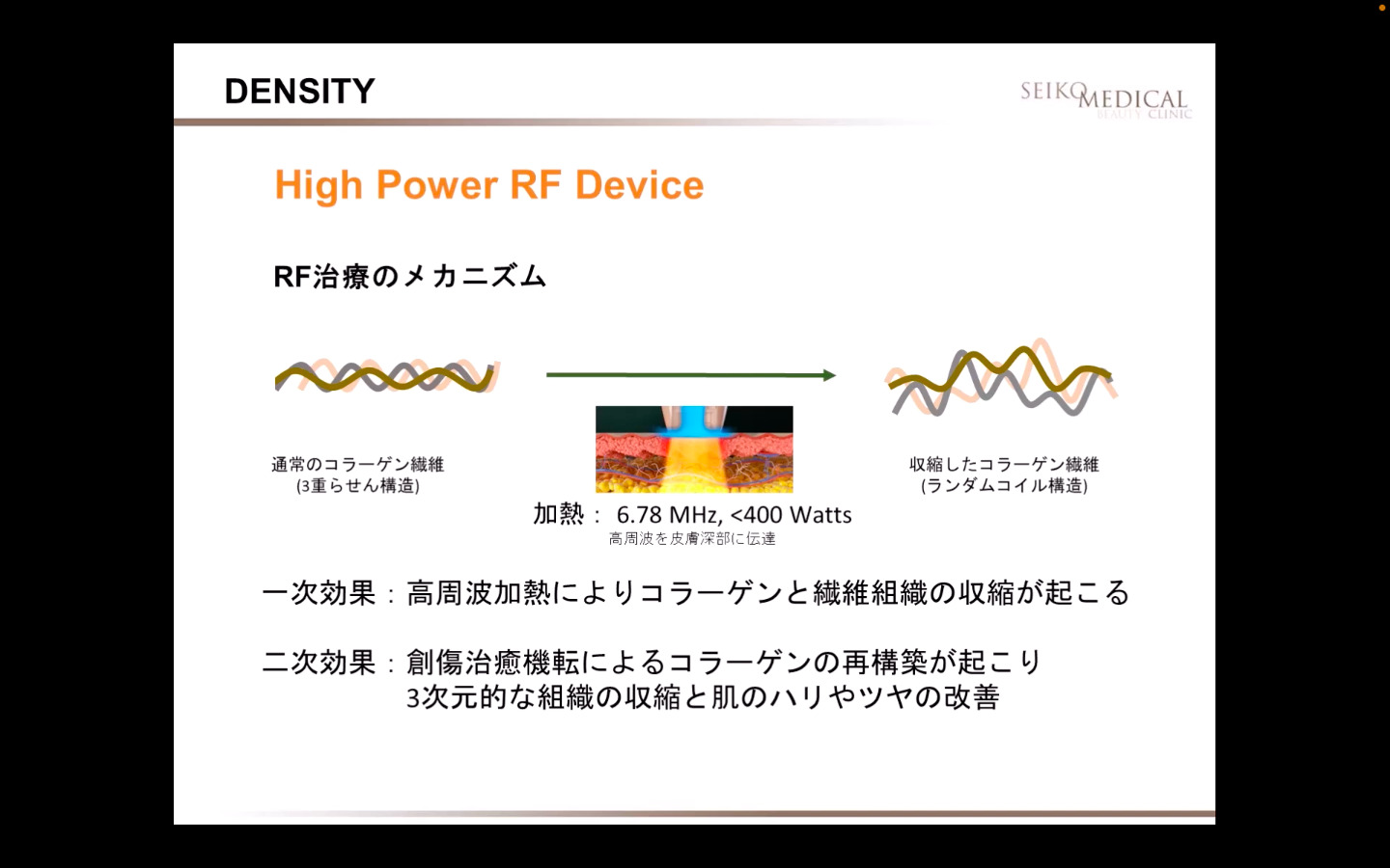 Overview of The Hot Topic, “DENSITY”- A Non-Invasive Pulsed RF Therapy ...